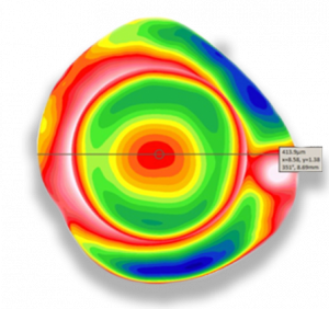 BostonSight SCLERAL | Your Partner in Saving Sight